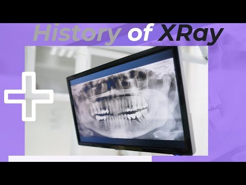 History of X-Ray And how x-Ray work - YouTube
