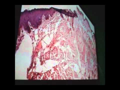 Histologia Lâmina de Lábio - YouTube