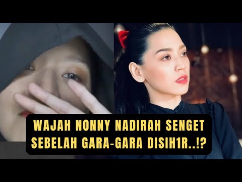 Nonny Nadirah alami wajah senget gara-gara disih1r oleh seorang individu yang dikenali⁉️