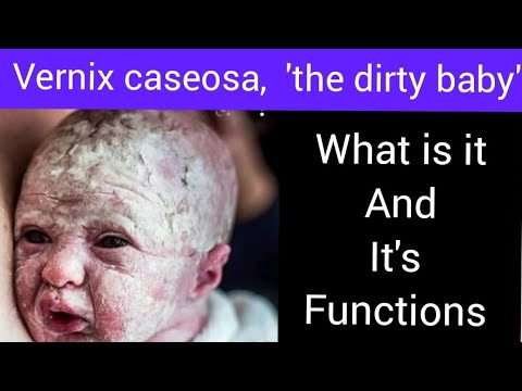 What's vernix caseosa, what is its benefits?? - YouTube