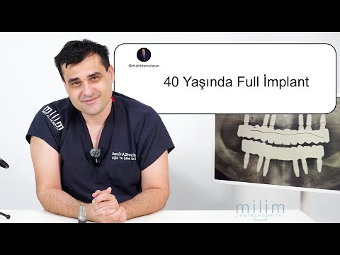 Çene Cerrahı Anlatıyor - 40 Yaşında Full İmplant