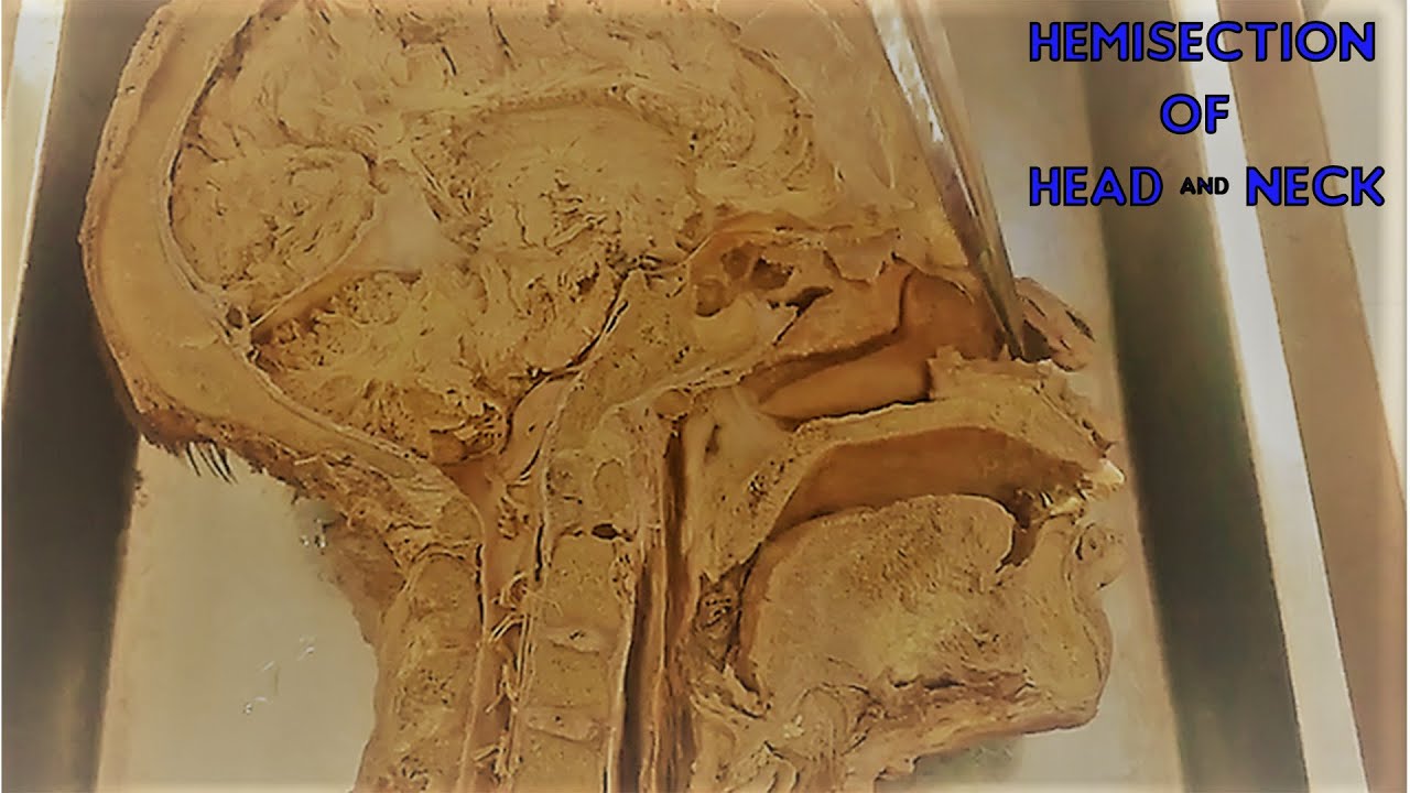 Hemisection of head and neck | Anatomy of hemisection (head and neck ...
