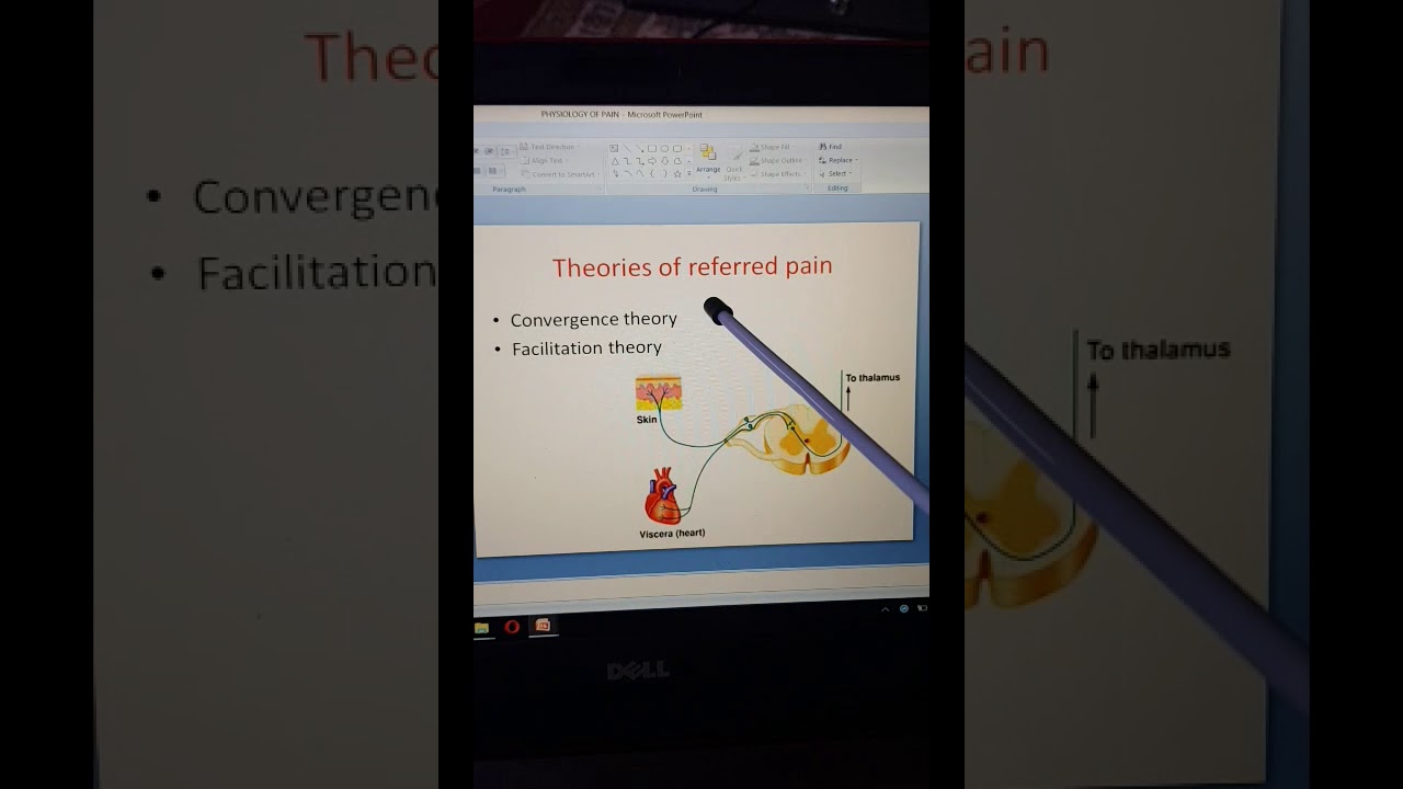 Convergence Theory of Referred Pain - YouTube