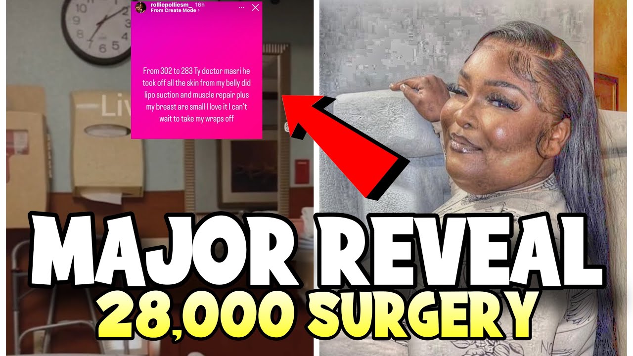 🚨 Rollie Pollie Just Revealed Details About Her MAJOR Surgery ‼️ - YouTube