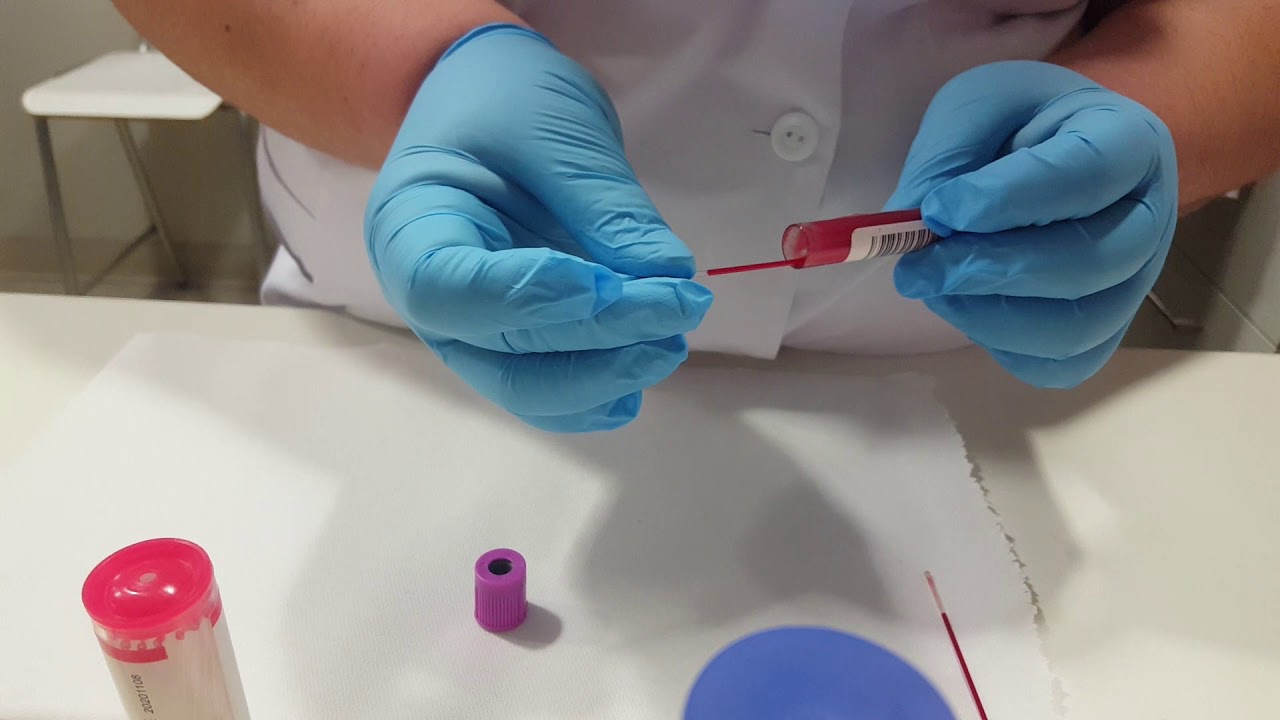 Técnica de Microhematocrito - YouTube