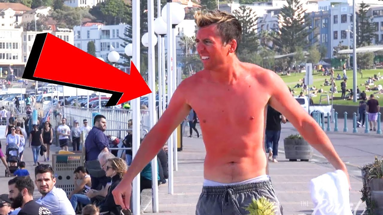 EPIC SUNBURN PRANK!! - YouTube