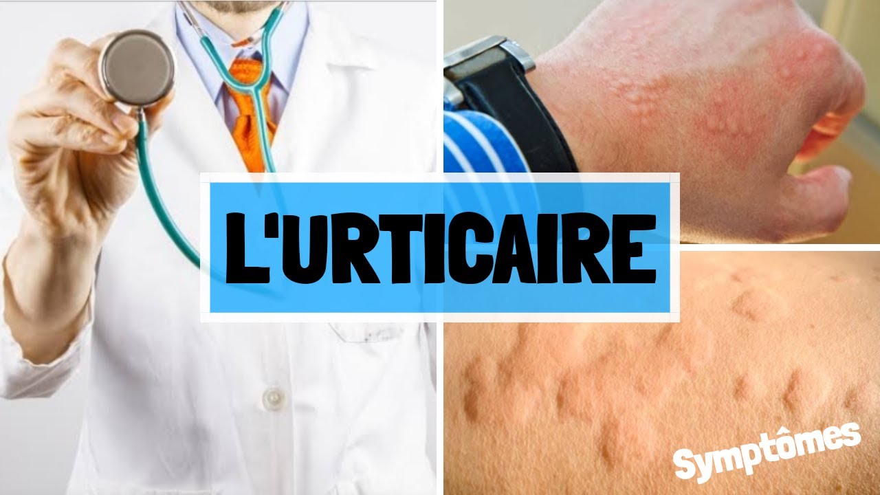 URITCAIRE ( CAUSES , SYMPTOMES , COMPLICATIONS , TRAITEMENT ) - YouTube