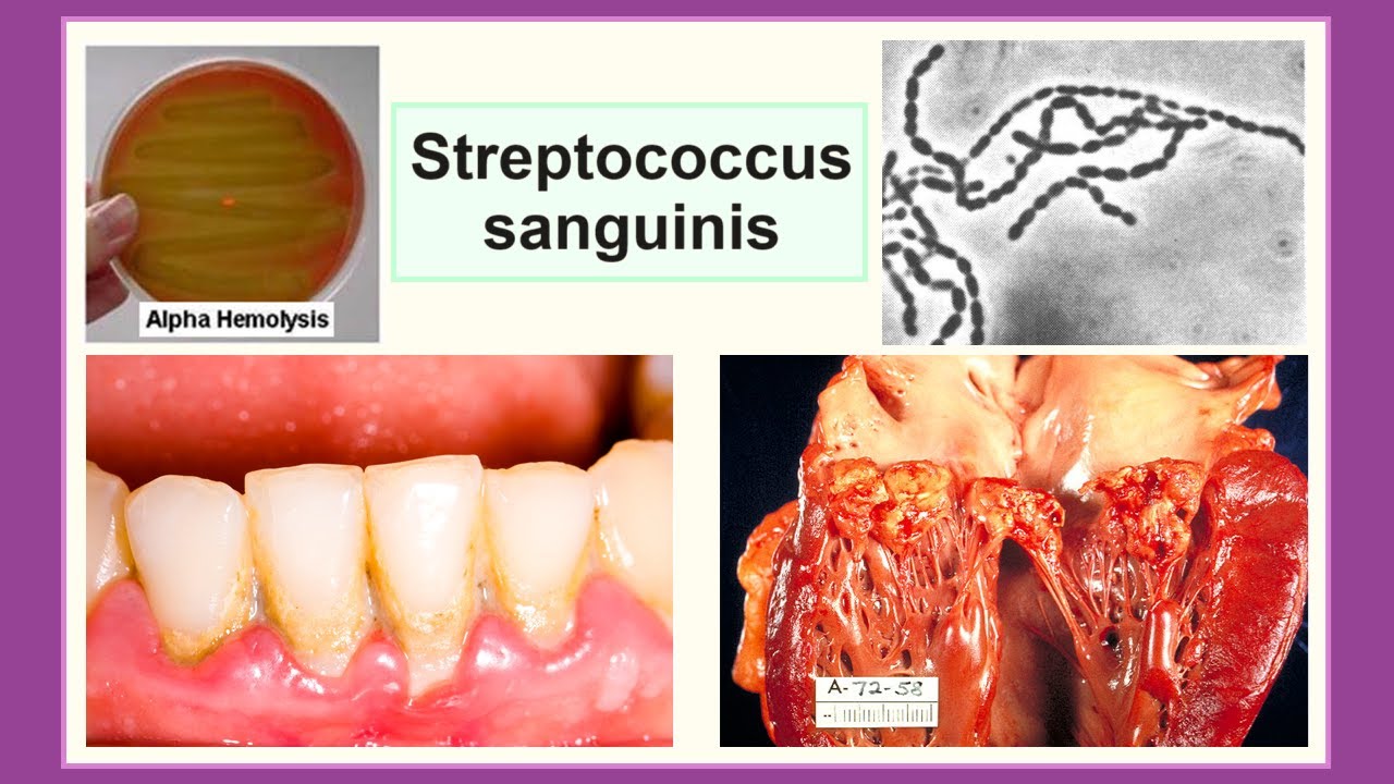 Streptococcus sanguinis - YouTube