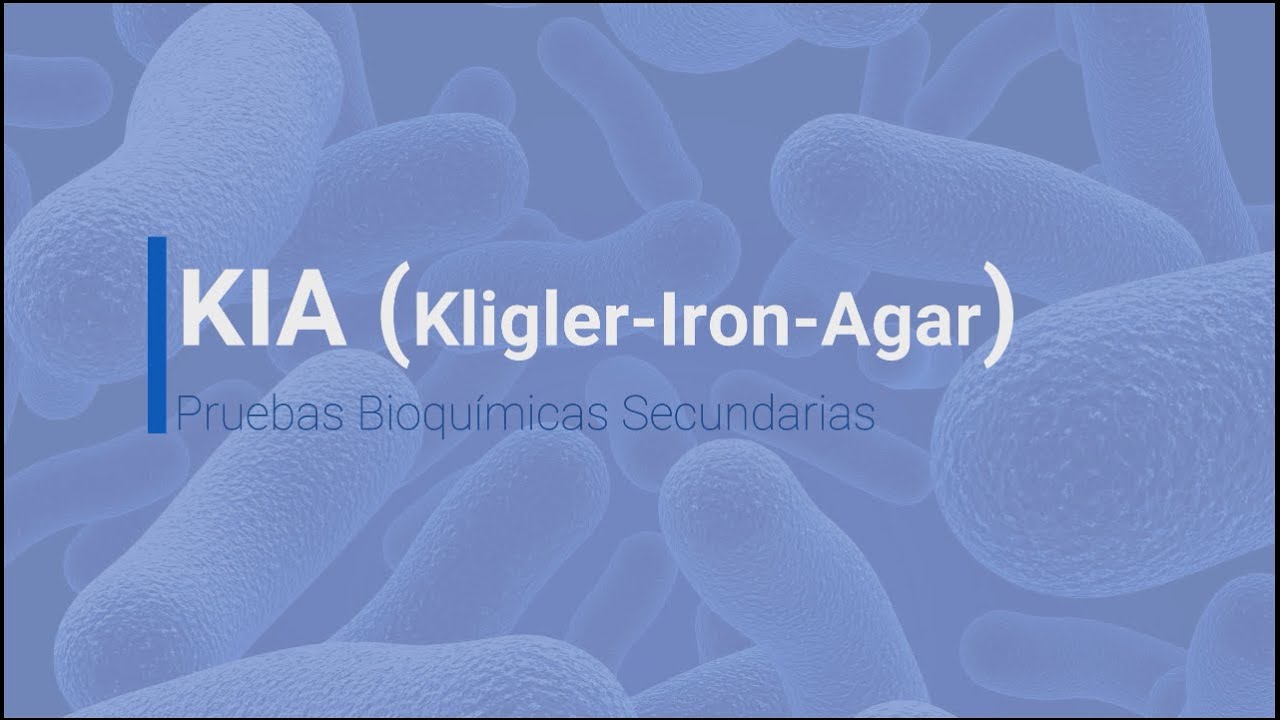 Prueba Bioquímica KIA (Kligler Iron Agar) - YouTube