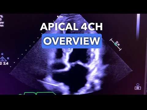 Apical 4 Chamber View - Echocardiography Education - YouTube