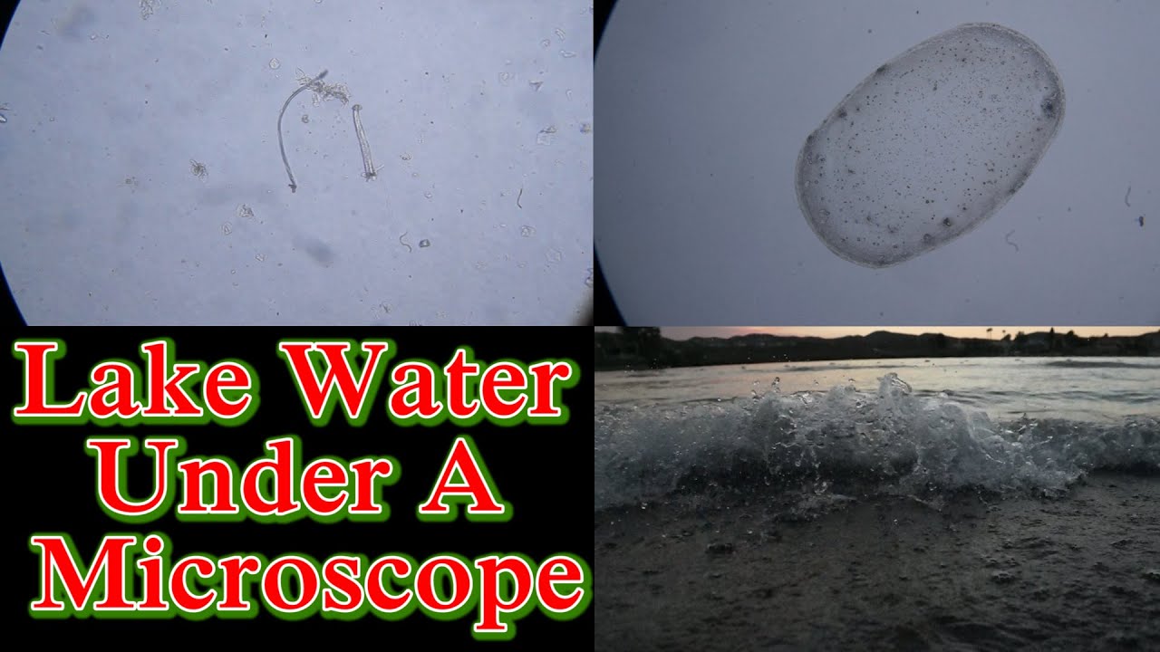 Lake Water Under A Microscope - YouTube