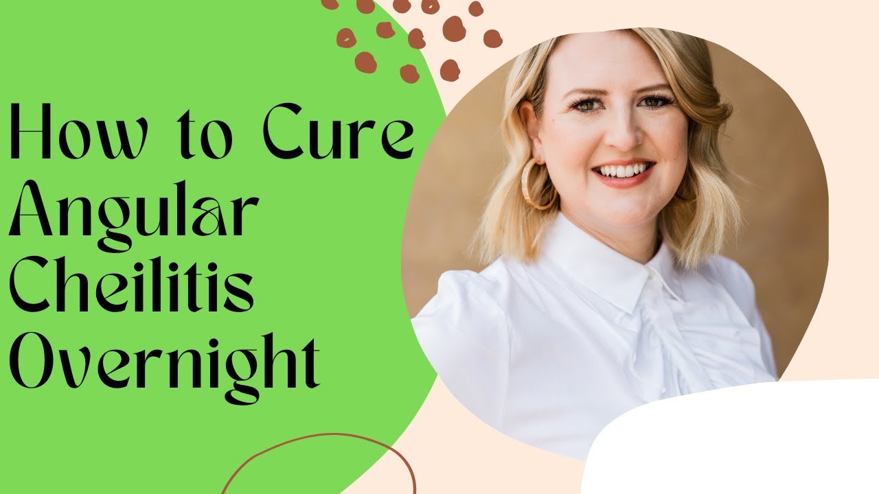How to Cure Angular Cheilitis Overnight - YouTube