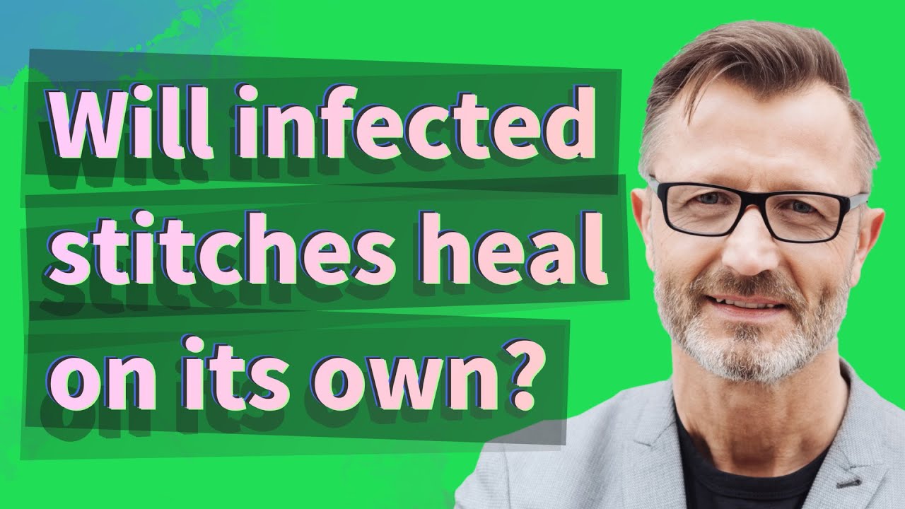 Will infected stitches heal on its own? - YouTube