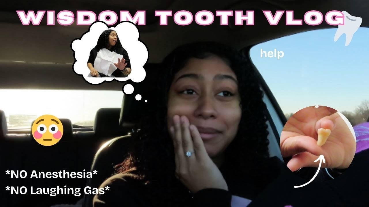 Come With Me To Get My Wisdom Tooth Out *NO Anesthesia or Laughing Gas ...