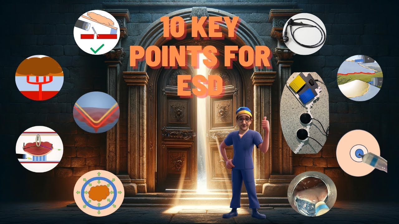 10 key points for better endoscopic submucosal dissection (ESD)! - YouTube