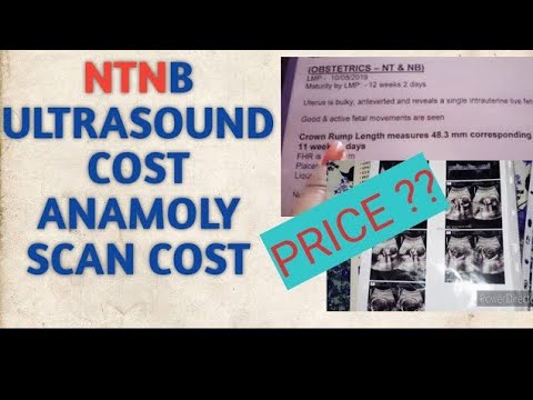 Nt Nb scan & Anamaly scan cost (level 2) Price, timings, Why? Can I ...