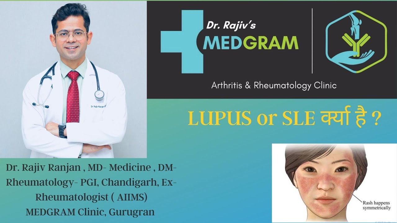 LUPUS / SLE kya hai ? (In Animation) by Dr. Rajiv Ranjan (DM ...
