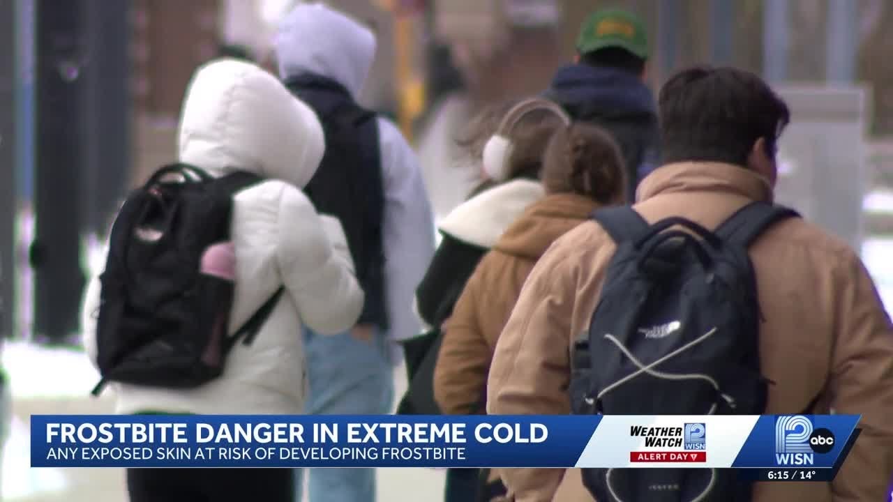 Health experts warn of cold weather dangers in Milwaukee - YouTube