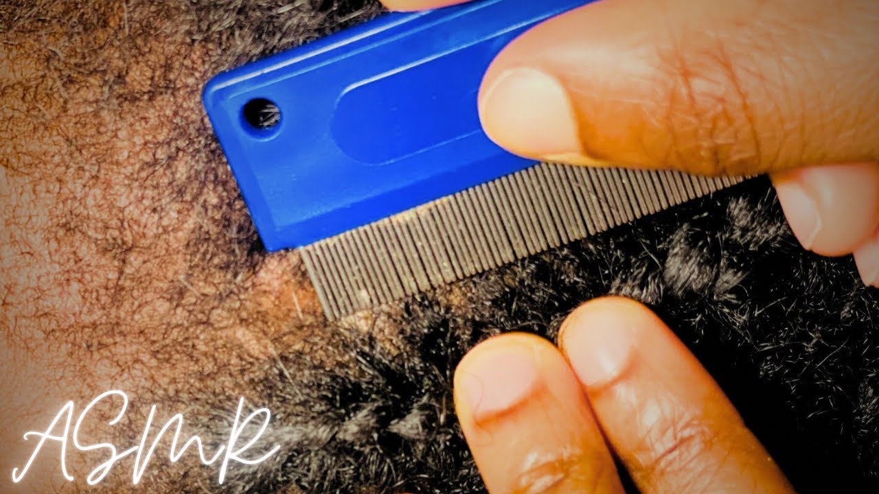 Gentle Scalp Scratch & Inspection | Abigho ASMR - YouTube