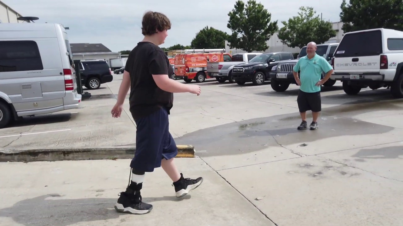 Jack, Symes Amputee on Patterson Propulsion Socket (PPS) - YouTube