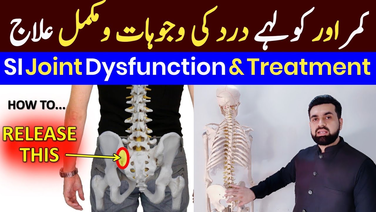 Sacroiliitis Types & Treatment | Sciatica & SIJ Dysfunction | Back Pain ...