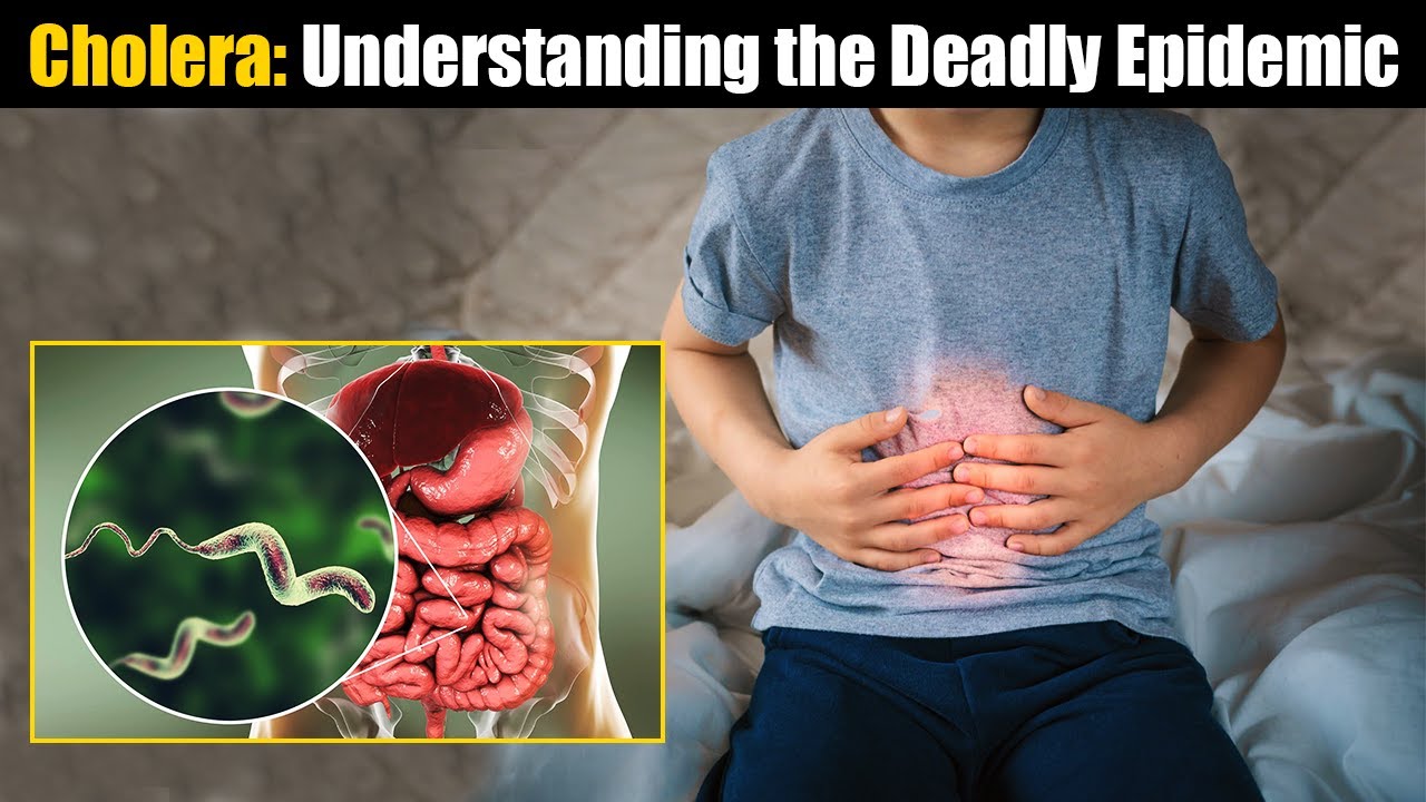 The Story of Cholera (Vibrio Cholerae): Causes, Risk Factors, Symptoms ...