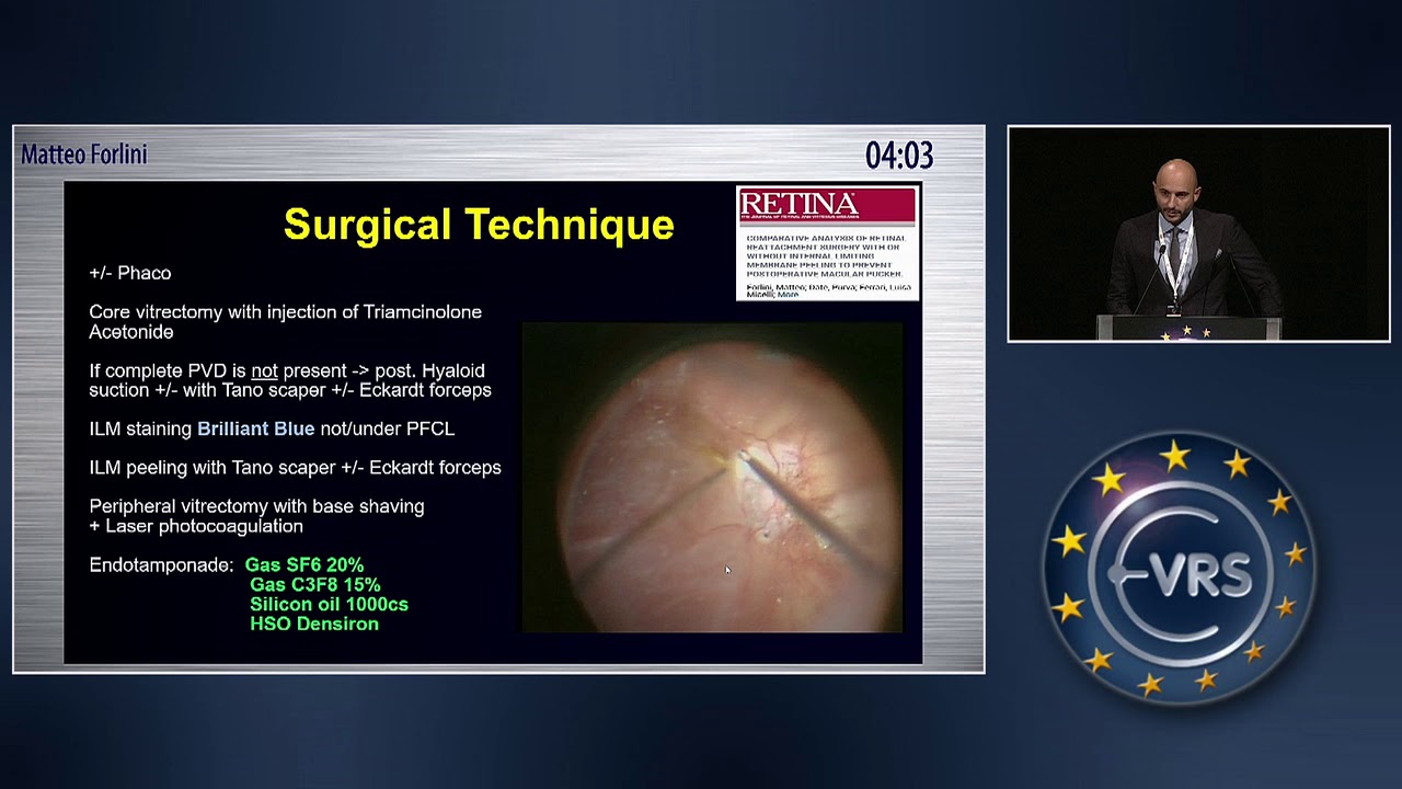 Comparative Analysis of Retinal Reattachment Surgery with or Without ...