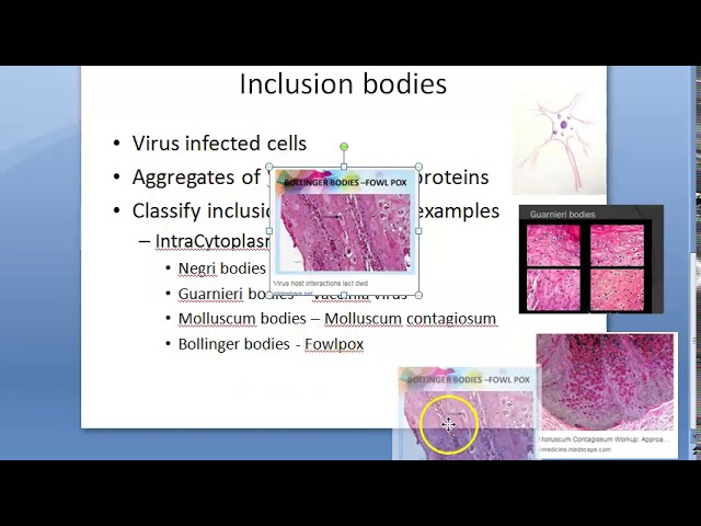 Inclusion Bodies Viral Negri Bodies Viral Inclusion Bodies