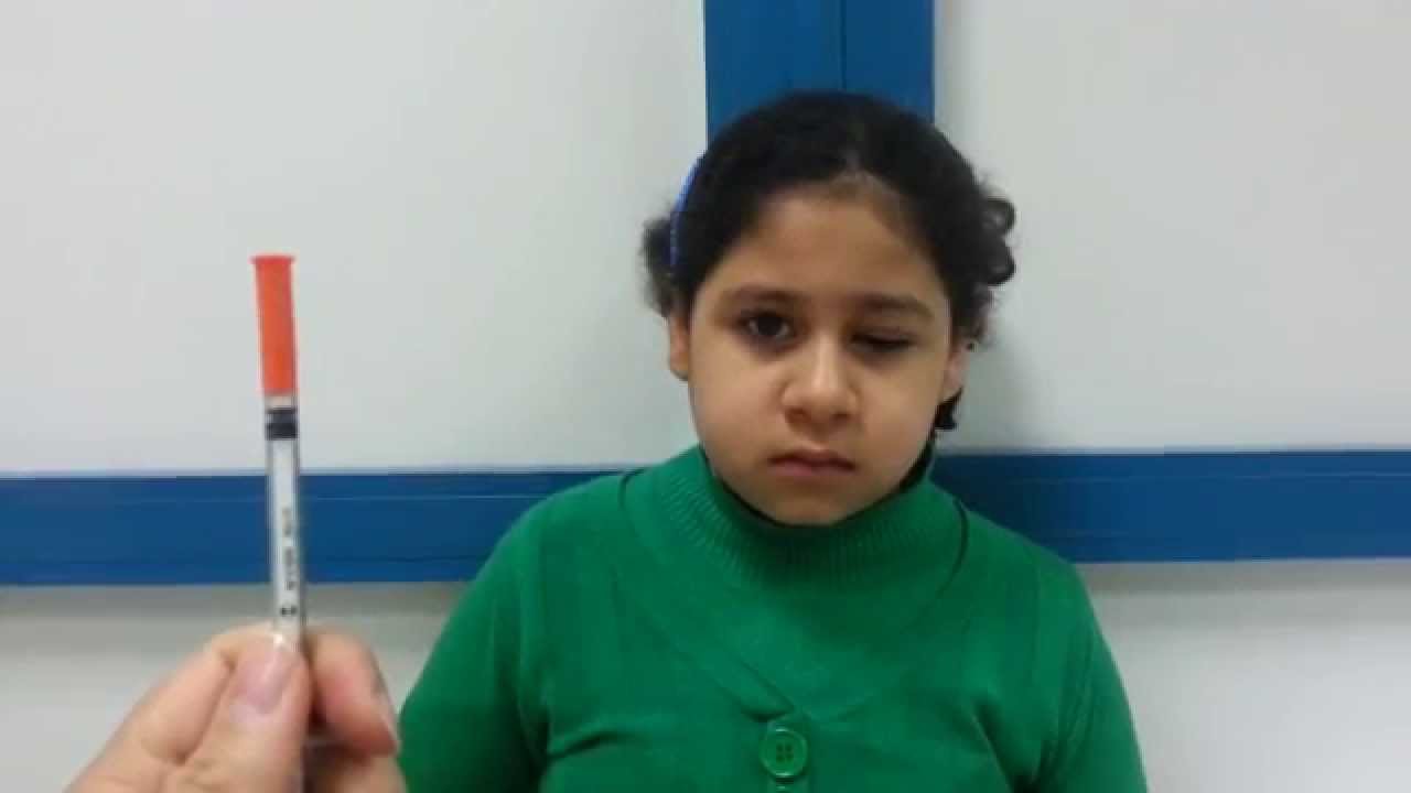 Bilateral Type III Duane Syndrome - YouTube