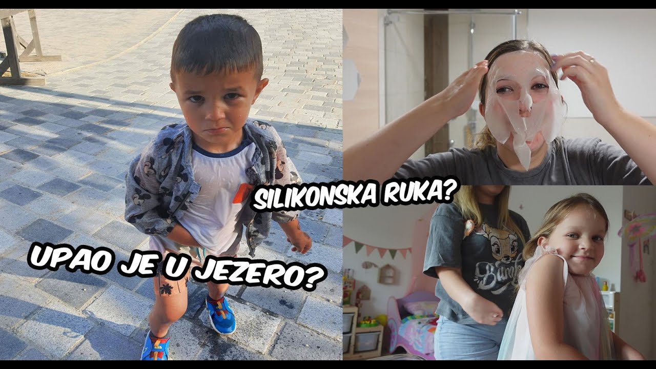 UPAO JE U JEZERO I Operacija ruke,silikonska proteza+ Prepali smo djecu ...
