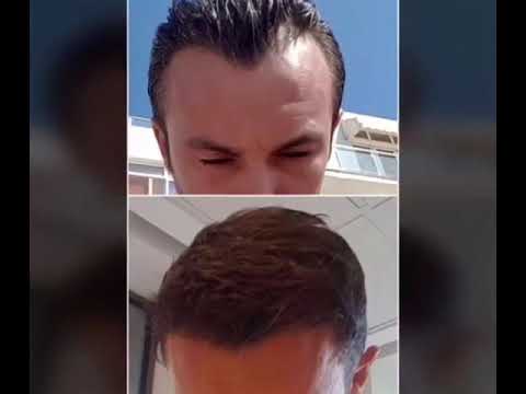 Saç Hakkında Her Şey