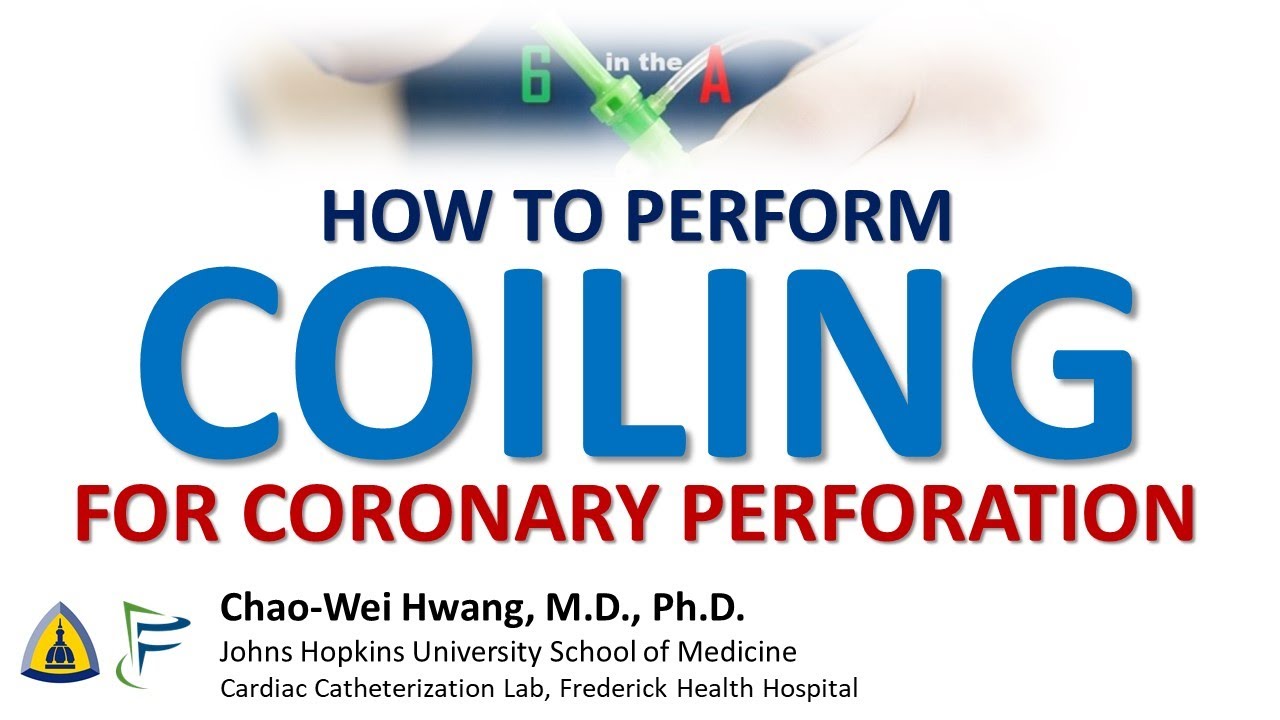 Coiling: Coronary Coils for Coronary Perforation - YouTube