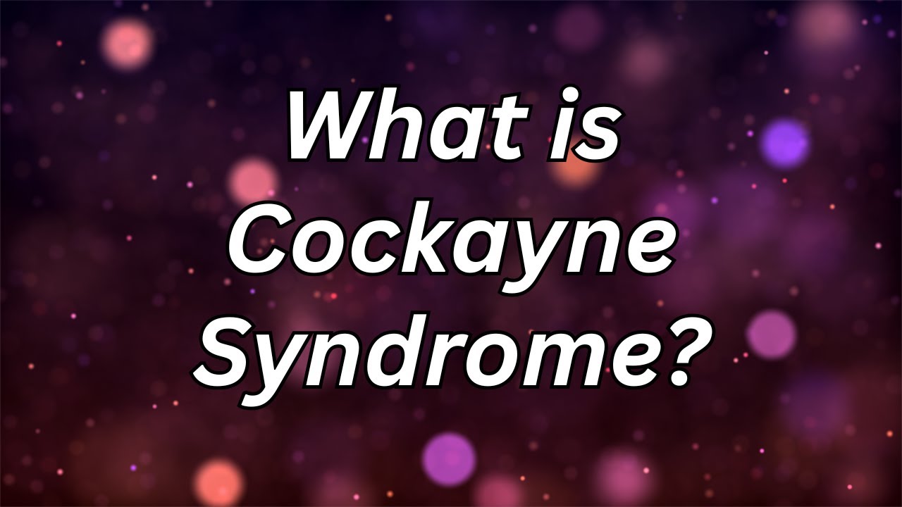 What is Cockayne Syndrome? - YouTube