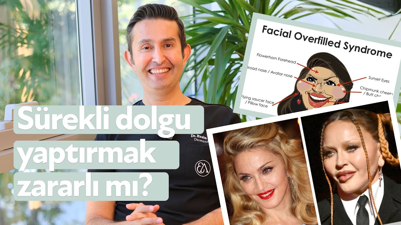 Sürekli Dolgu Yaptırmak Zararlı Mı? Face Over Filled Seyndrome Nedir ...