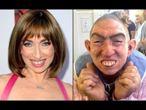 Before And After Celeb Makeup Transformation