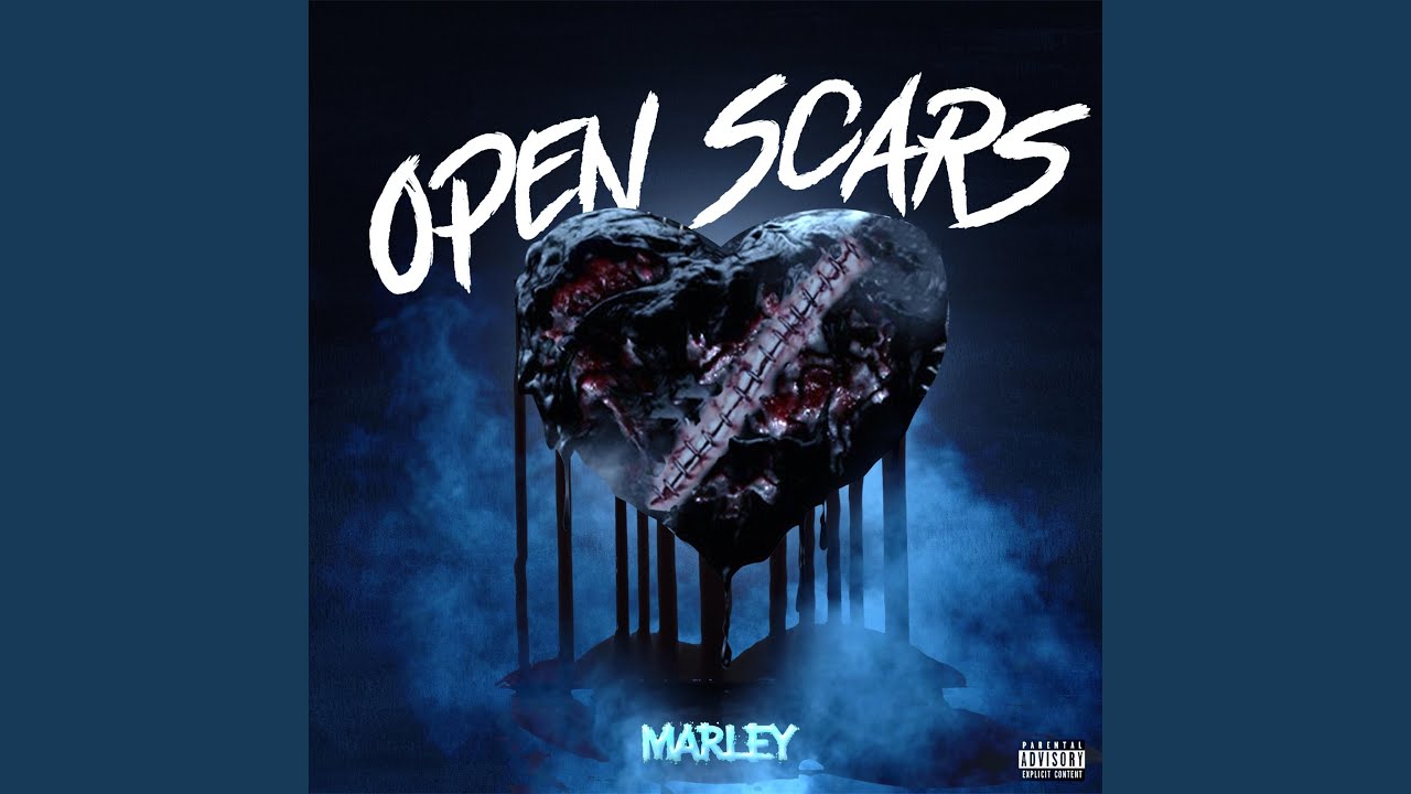 Open Scars - YouTube