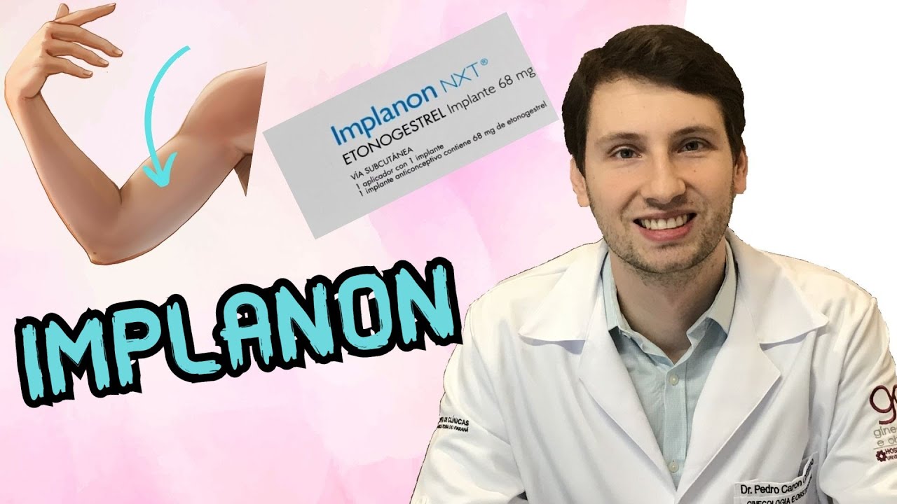 SAIBA: ANTICONCEPCIONAL IMPLANON, como colocar, efeitos colaterais ...