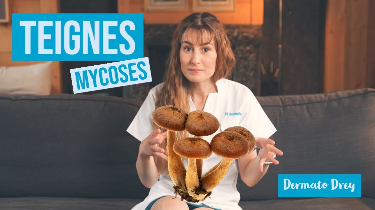 Les teignes ! Parlons mycoses, c'est la saison des champignons ...