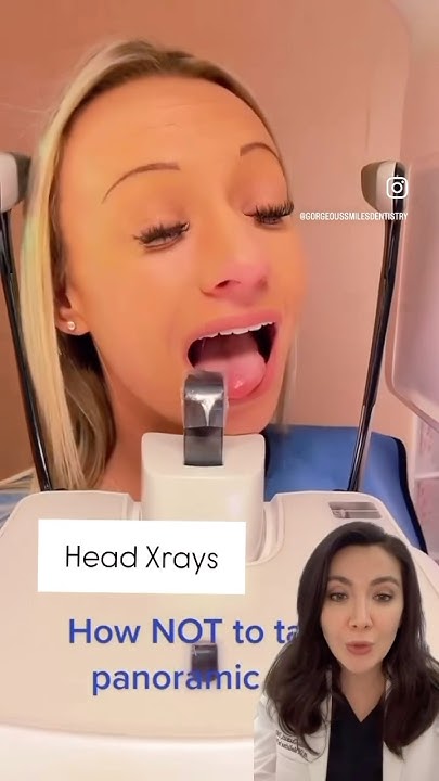 Taking Head Xray! - YouTube