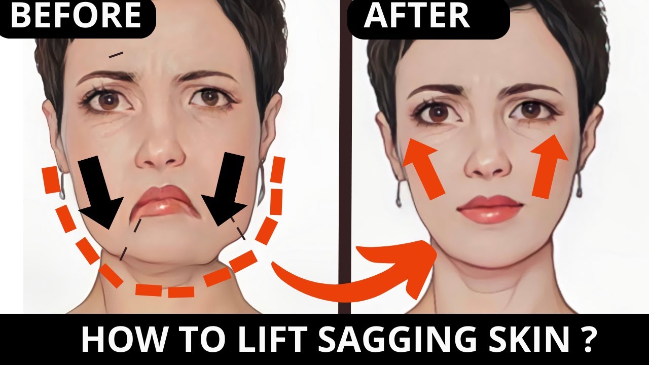 🛑 ANTI-AGING FACE LIFTING EXERCISES FOR SAGGING SKIN, JOWLS, NASOLABIAL ...