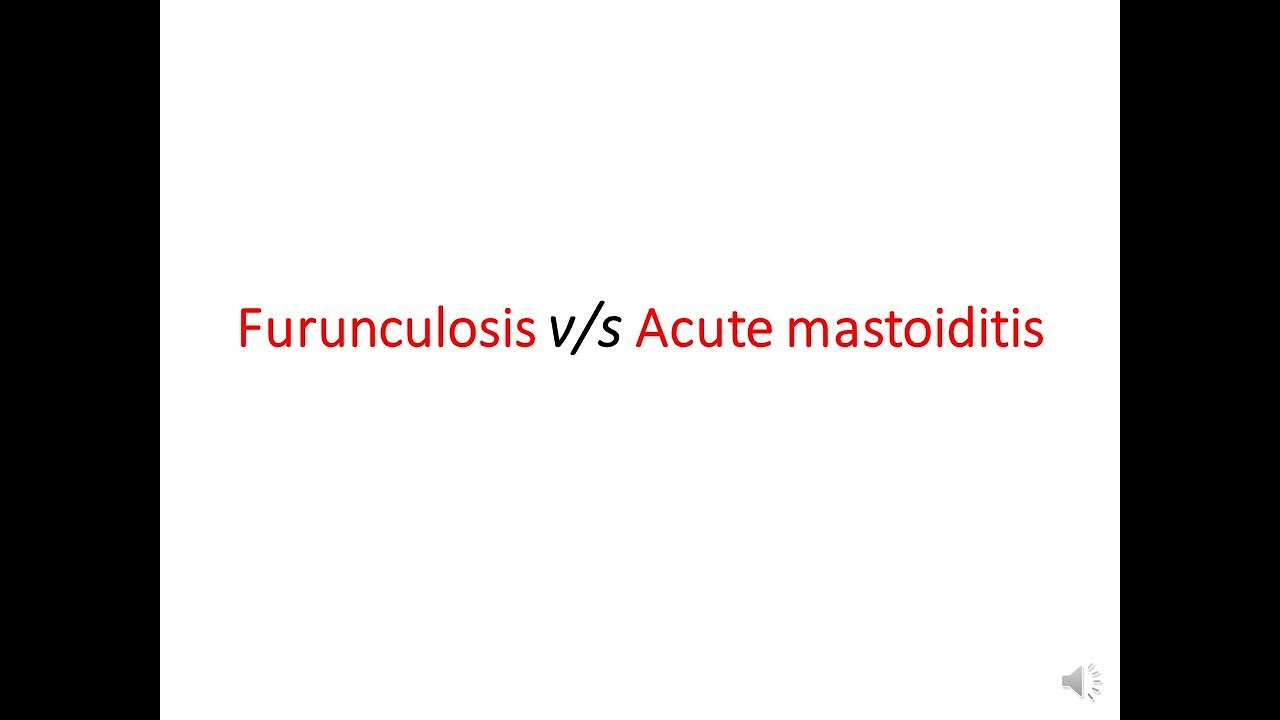 Furunculosis v/s Acute mastoiditis | ENT - YouTube