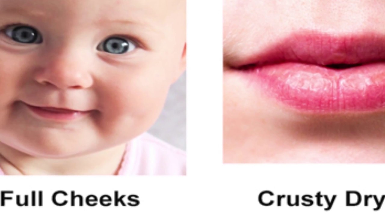 What are the Symptoms of Poor Facial Growth? O'Connor Dental Health ...