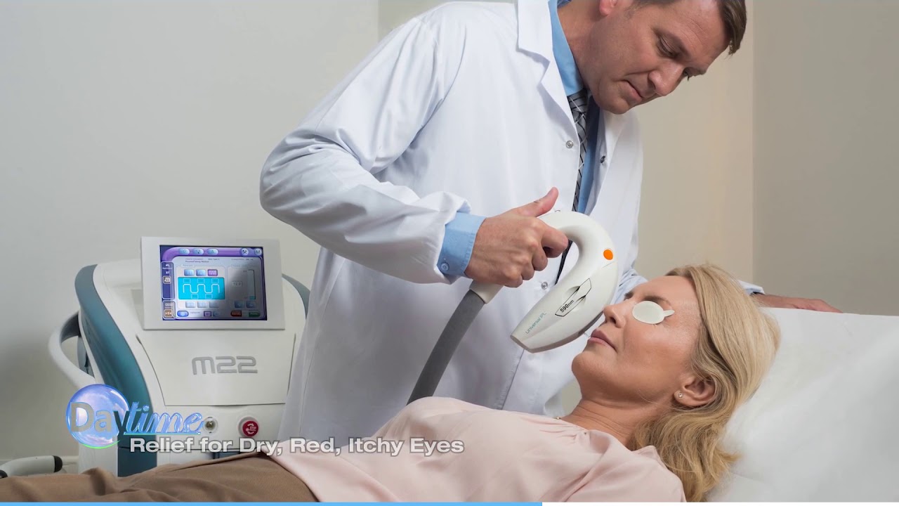 Optima IPL Uses Light Pulse Technology to Relieve Dry Eye - YouTube