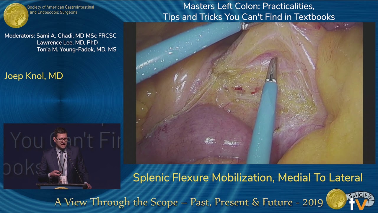 Splenic flexture - veloholden