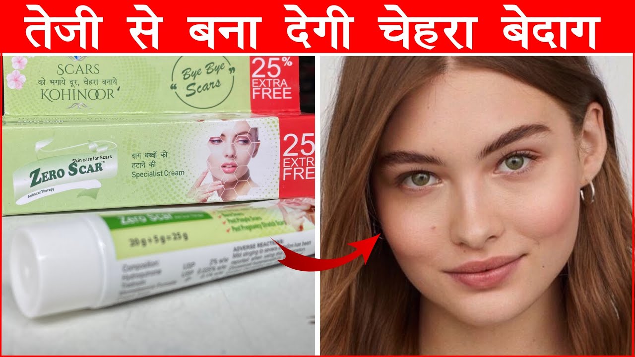 Zero scar cream | Pimple, Acne, Strech Marks, सब ख़त्म करदे | Hindi ...