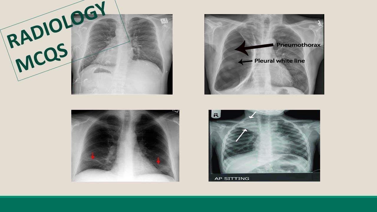 X-RAY IMAGE BASED MCQS, OF RADIOLOGY, FOR RADIOGRAPHERS EXAM. - YouTube