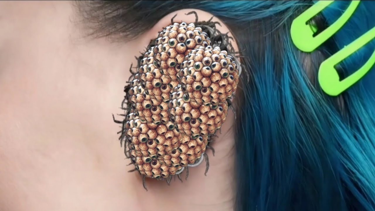 ASMR Animation Treatment Infected Ear,, Women Ear Treatment Collection ...