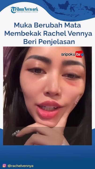 Muka Berubah Mata Membekak, Rachel Vennya Beri Penjelasan - YouTube