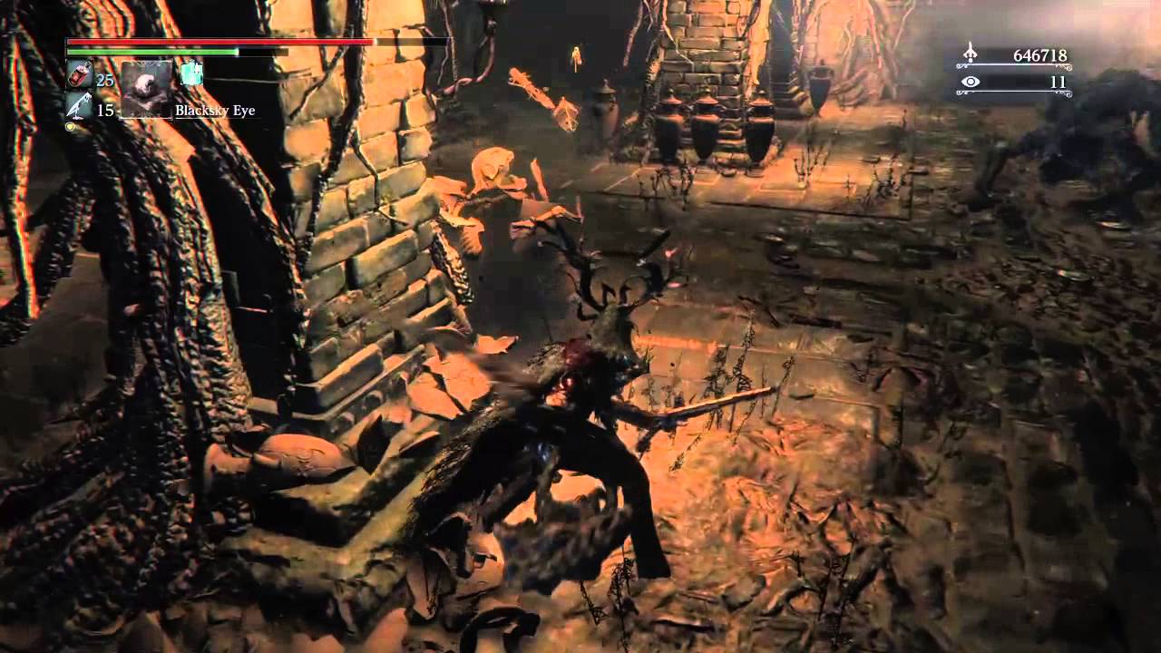 Bloodborne Amygdalan Arm Chalice Dungeons - YouTube