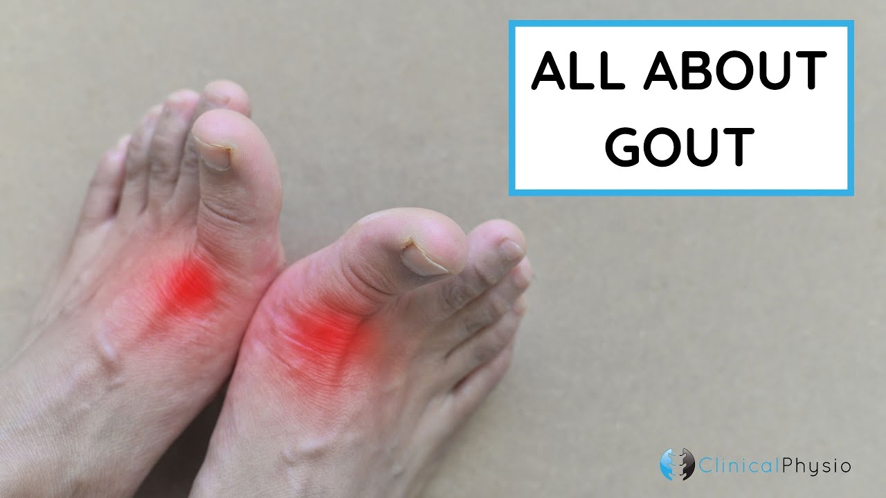 What is Gout? All you need to know! - YouTube